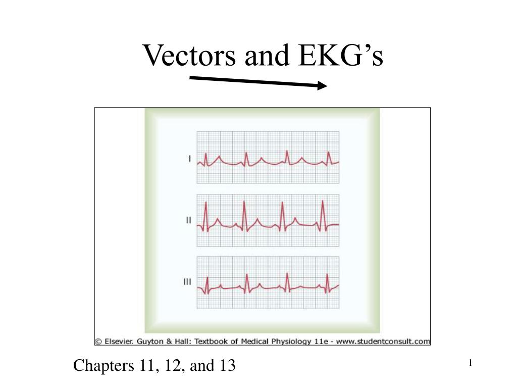 PPT - Vectors and EKG’s PowerPoint Presentation, free download - ID:6717421