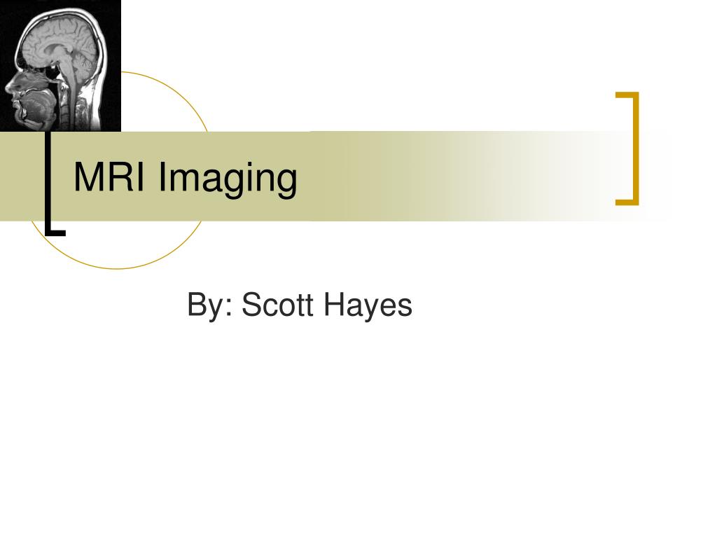 PPT - MRI Imaging PowerPoint Presentation, free download - ID:6726623