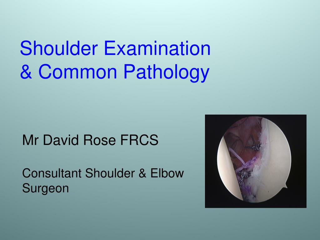 PPT - Shoulder Examination & Common Pathology PowerPoint Presentation ...