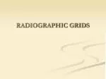 PPT - RADIOGRAPHIC ARTIFACTS PowerPoint Presentation, free download ...