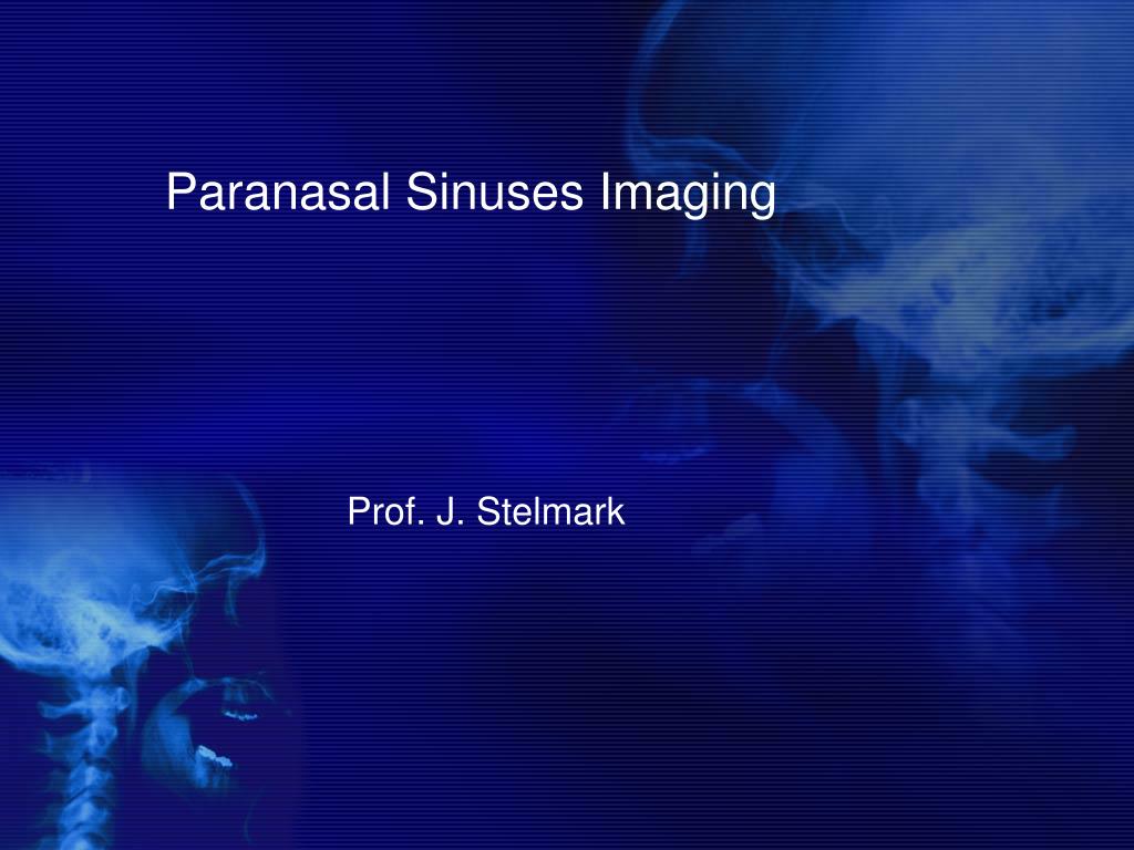 PPT - Paranasal Sinuses Imaging PowerPoint Presentation, free download ...