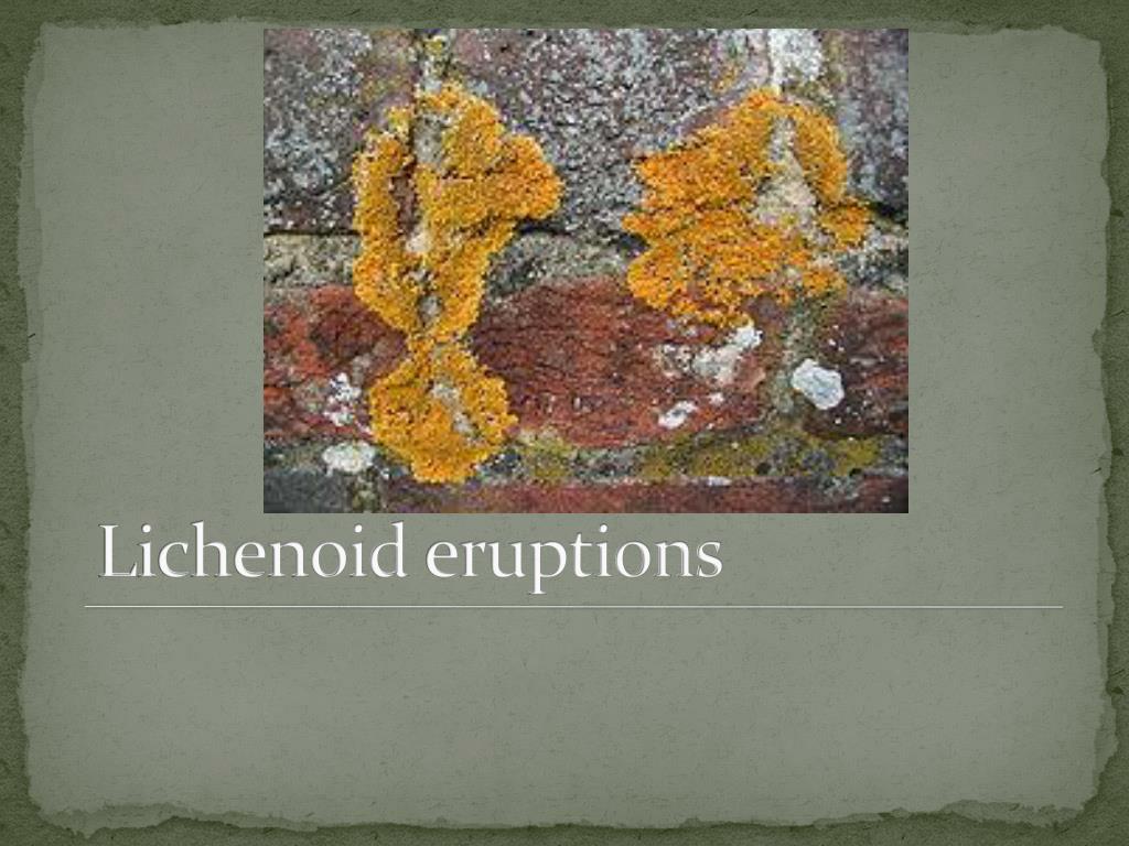 PPT - Lichenoid eruptions PowerPoint Presentation, free download - ID ...
