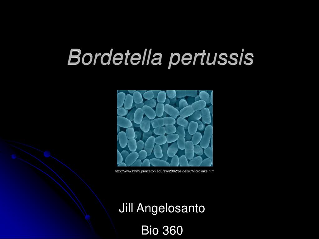PPT - Bordetella pertussis PowerPoint Presentation, free download - ID:6785644