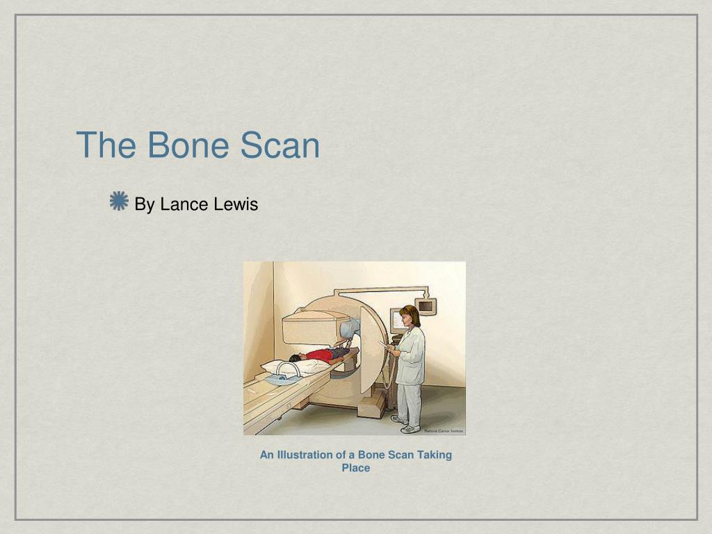 PPT - The Bone Scan PowerPoint Presentation, free download - ID:6810369