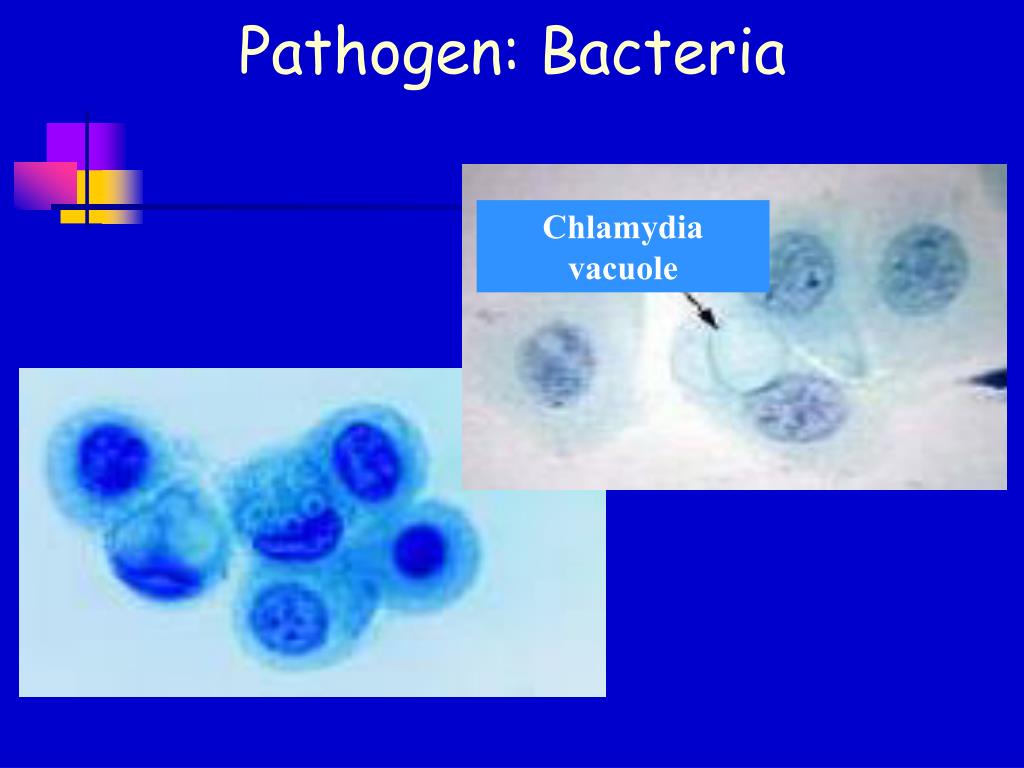 PPT - Pathogen: Bacteria PowerPoint Presentation, free download - ID ...