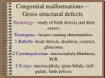 PPT - CONGENITAL ANOMALIES (Birth defects) PowerPoint Presentation ...