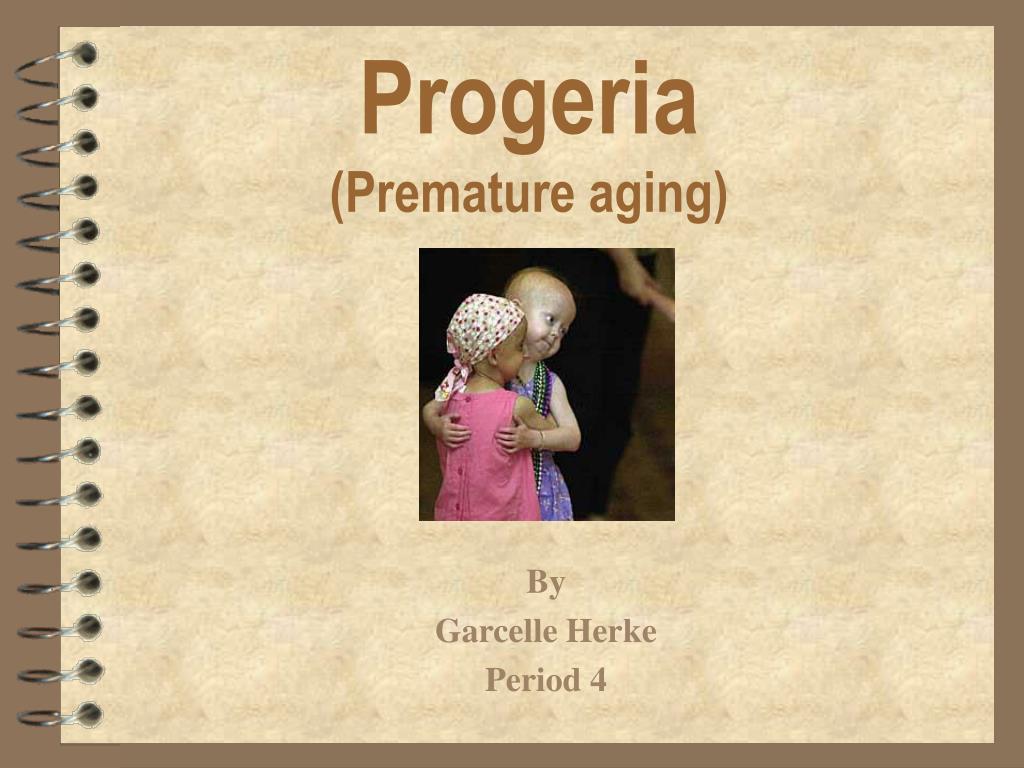 PPT - Progeria (Premature aging) PowerPoint Presentation, free download ...