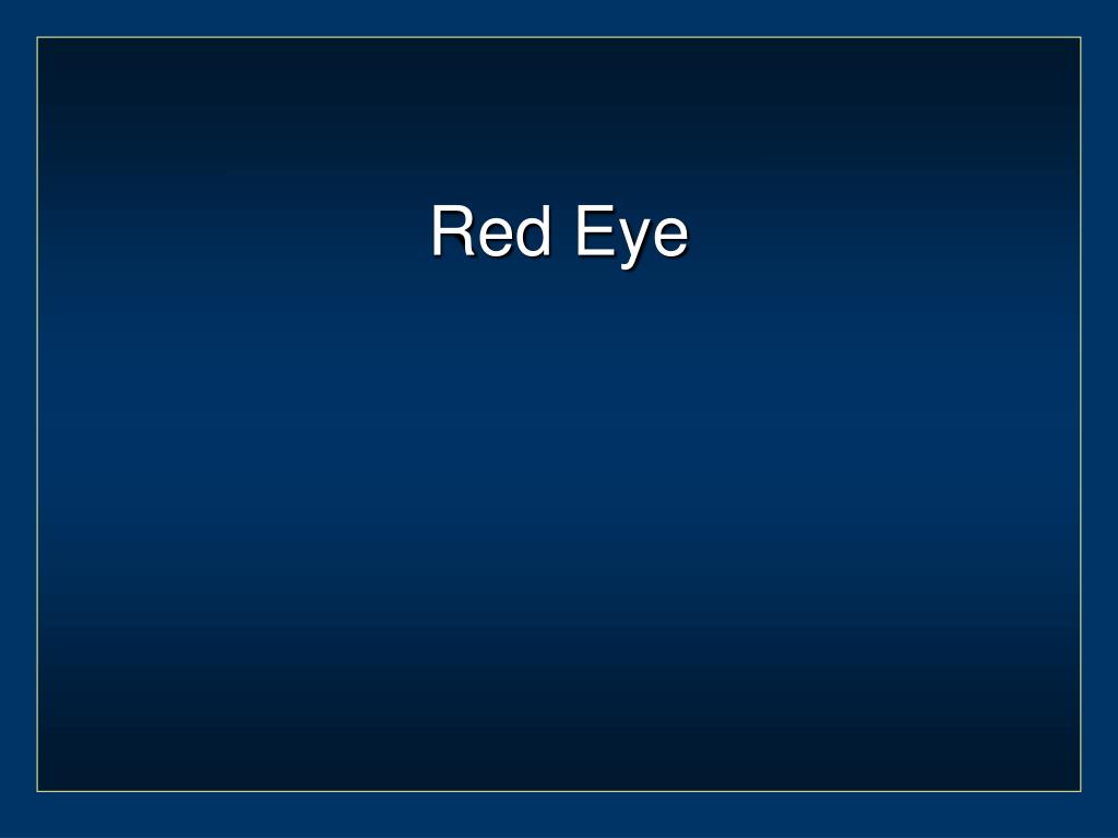 PPT - Red Eye PowerPoint Presentation, free download - ID:6983014