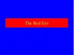 PPT - RED EYE PowerPoint Presentation, free download - ID:4462254
