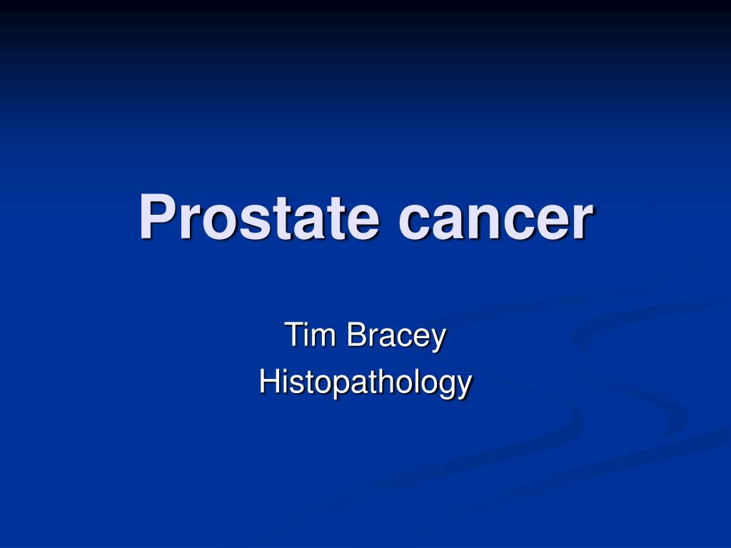 PPT - Prostate cancer PowerPoint Presentation, free download - ID:7013947