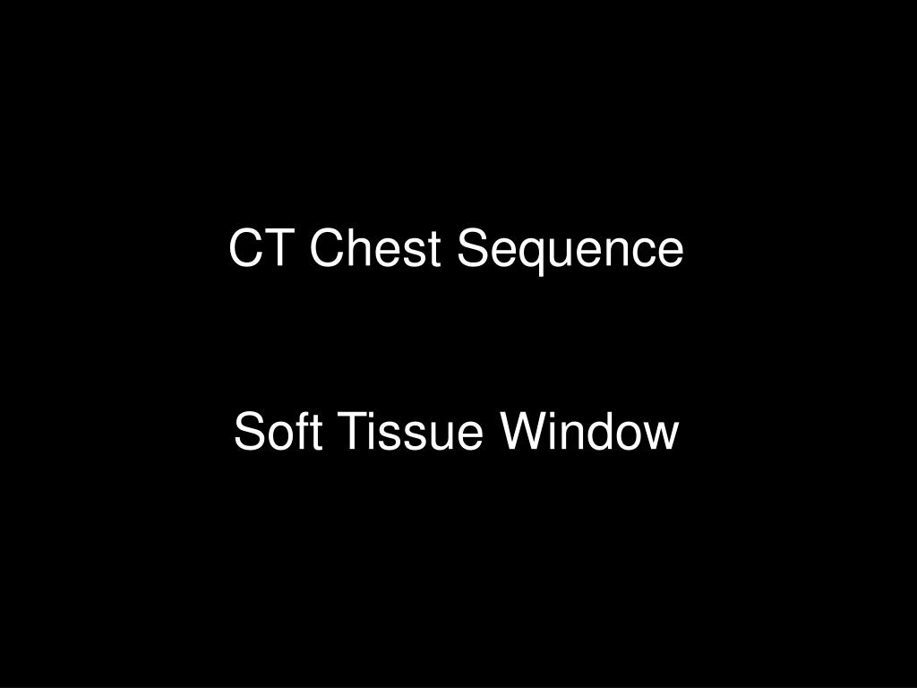 PPT - CT Chest Sequence Soft Tissue Window PowerPoint Presentation ...