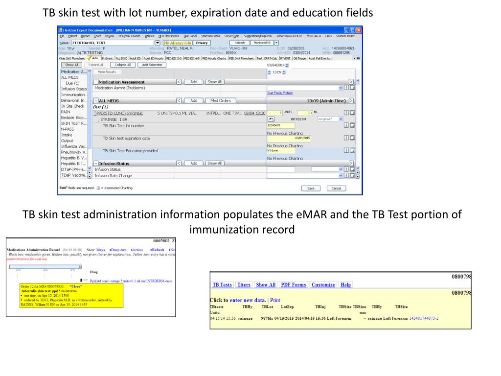 PPT - TB skin test with lot number, expiration date and education ...
